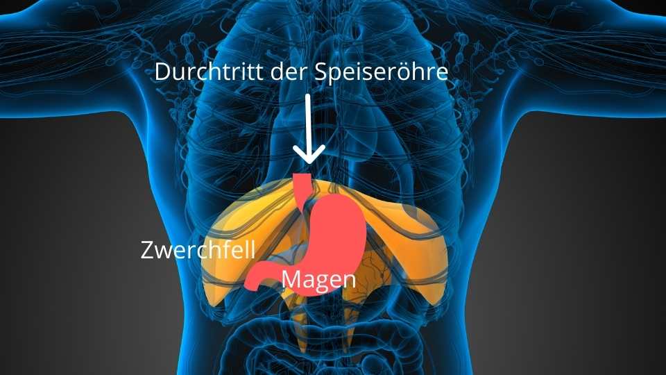 Zwerchfellbruch energetisch verbessern - Quantum-Wave